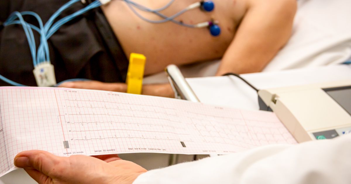 การตรวจคลื่นไฟฟ้าหัวใจ (EKG/ECG) - MedPark Hospital